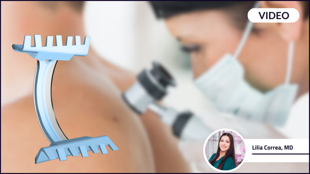 DermaBlade: Why Use DermaBlade for Shave Biopsy? | AccuThrive